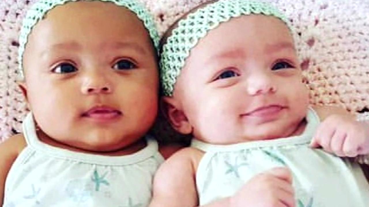 Biracial twins, born with different complexions, become social media ...
