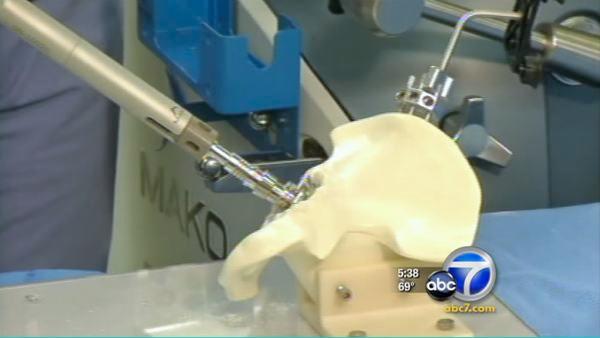 Mako Hip Surgery in LA Another Great Video | MAKO Message Board Posts